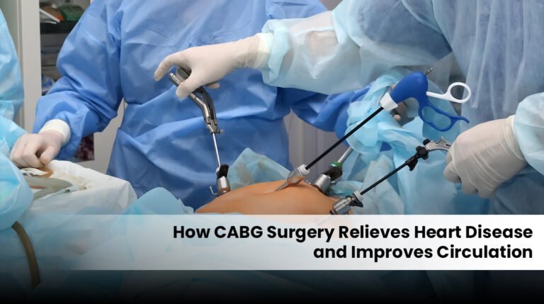 How CABG Surgery Relieves Heart Disease And Improves Circulation