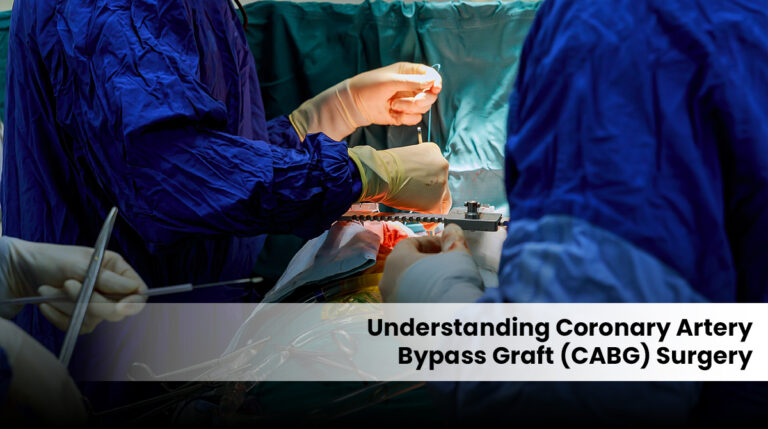 Understanding Coronary Artery Bypass Graft (CABG) Surgery